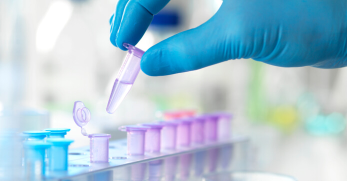 Why process matters: how biologics process development can accelerate ...